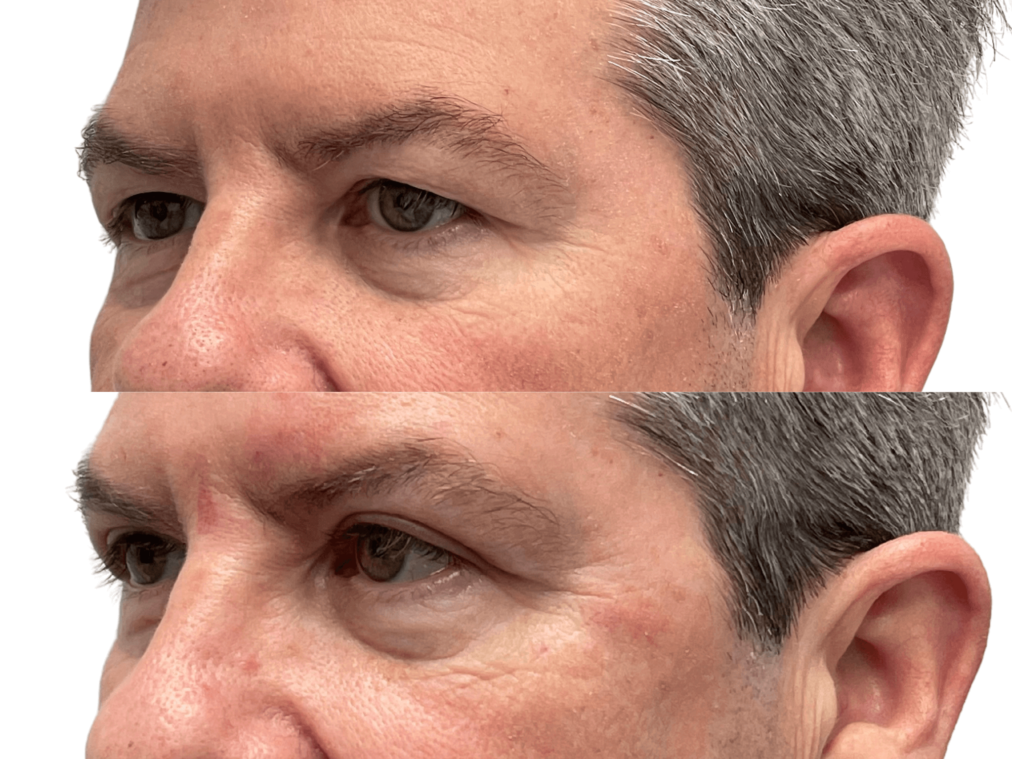 Facial Plastic Surgery For Men | Gallo MD