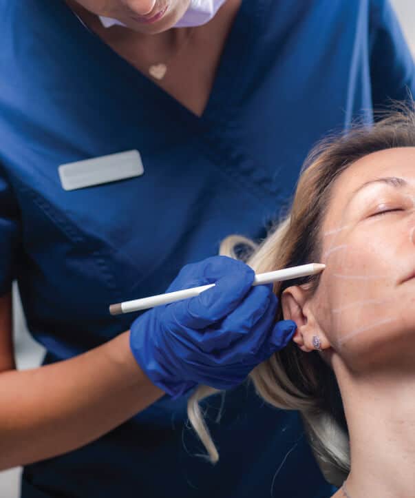 NovaThreads Cheek and Face Lift in Miami | Non-Surgical